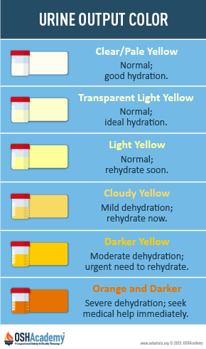 Urine Output Color
